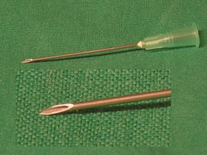 Abortion Methods - Louisiana Right to Life